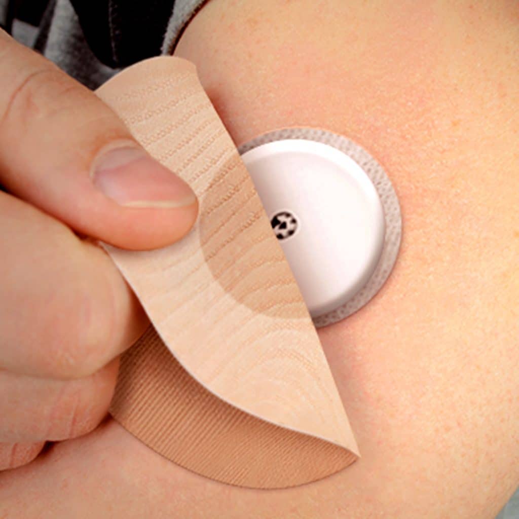 Parches adhesivos protectores para Freestyle Libre o Medtronic - Fixic ...